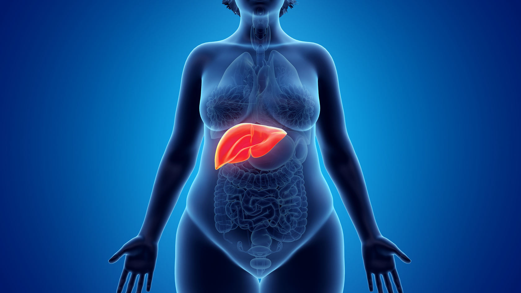 Fettleber kommt nicht vom Alkohol allein: Ernährung unter der Lupe